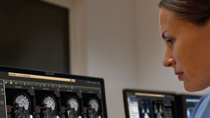 IntelliSpace Enterprise Imaging Solution | Enterprise Imaging PACS ...